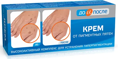 Крем от пигментных пятен До и После 50 мл. купить в интернет-магазине ...